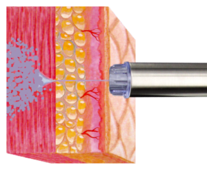 How It Works – MIT Canada